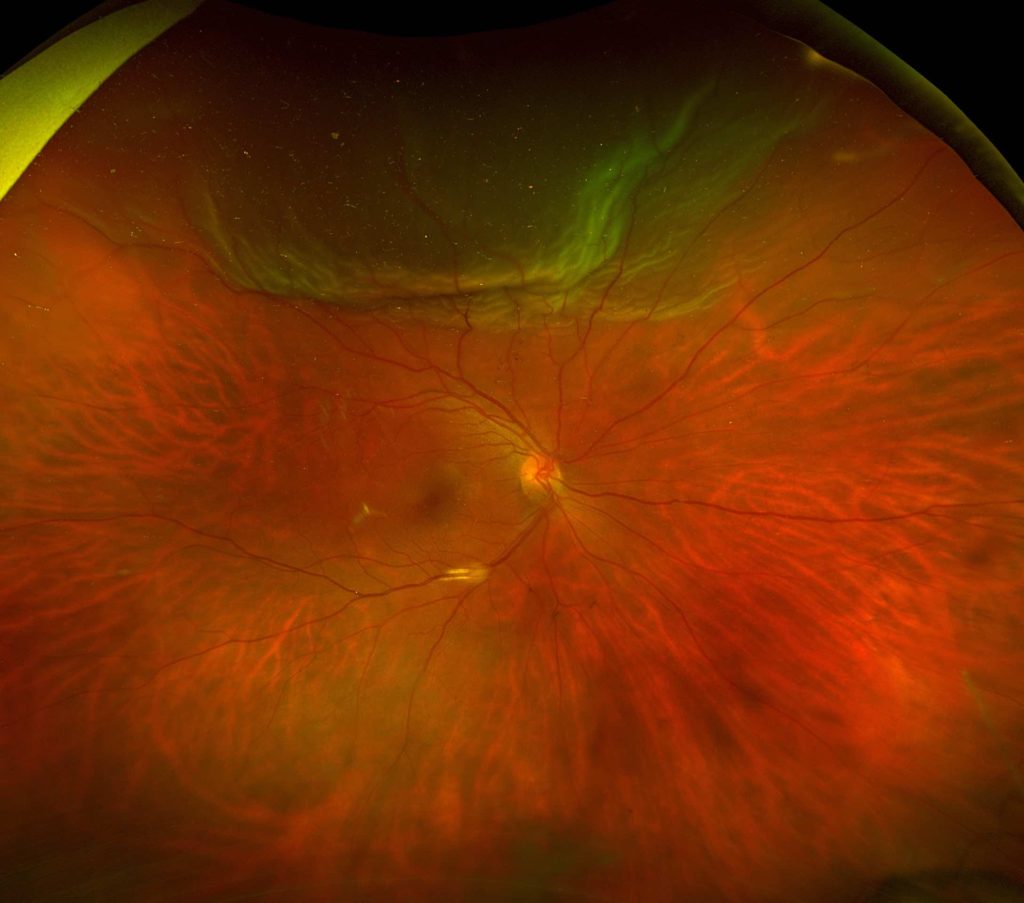 Services – PACIFIC RETINA – Medical and Surgical Retina and Ophthalmology